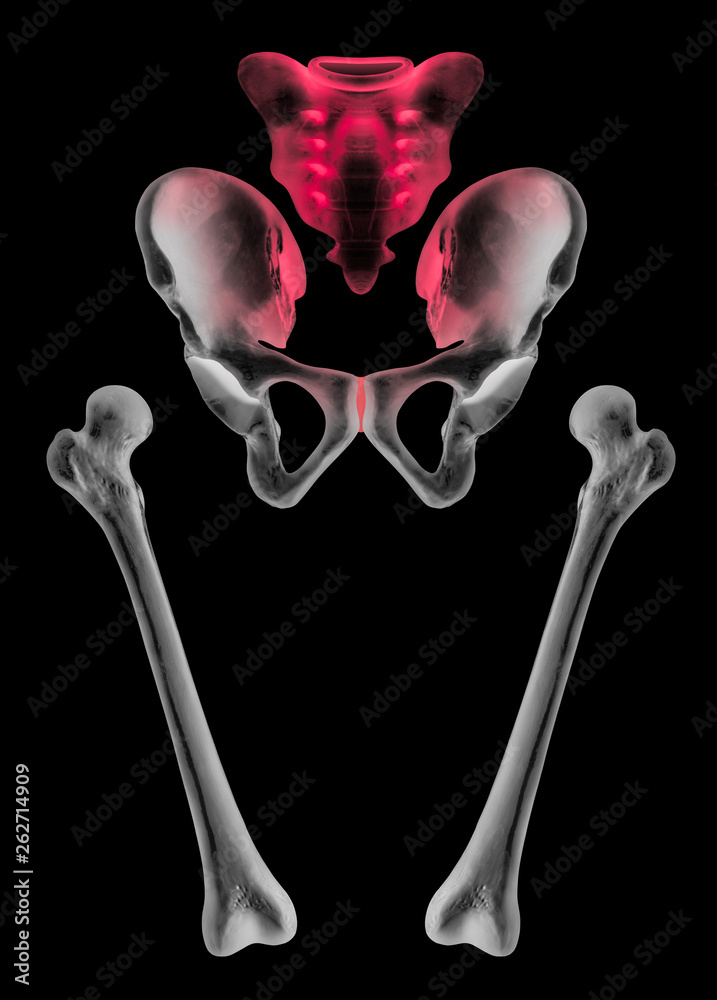 X-ray of separate human hip and femur bone anterior view red highlight ...