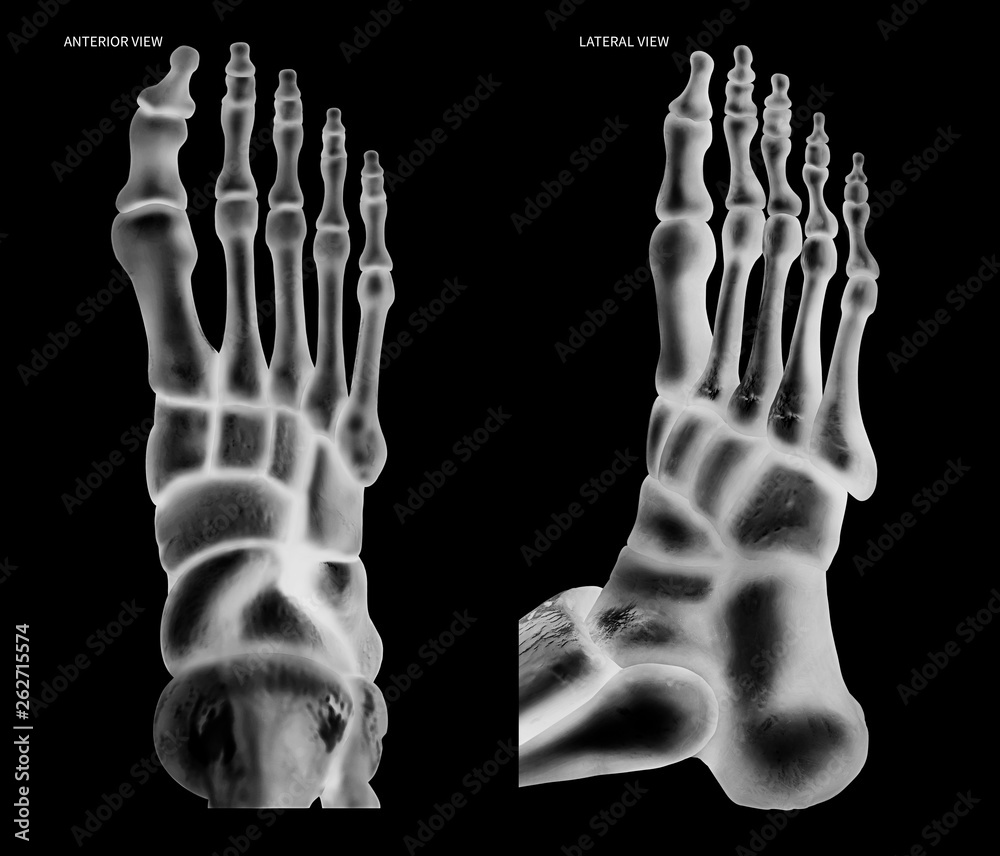 Foot Bone Anatomy Xray