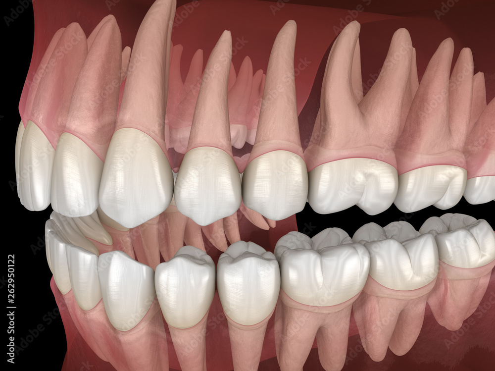 Morphology of mandibular and maxillary human gum and teeth. Medically ...