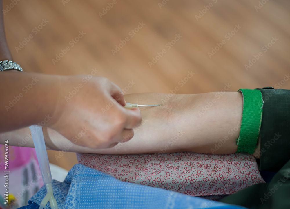 The needle is stabbed into the blood vessel. Stock Photo | Adobe Stock