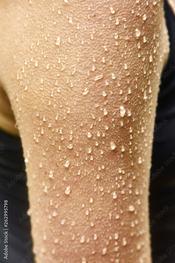 Goosebumps and drops of water on the female skin. Stock Photo | Adobe Stock