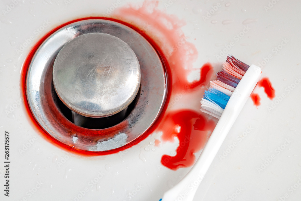 Bleeding gums when brushing the teeth and gingivitis concept theme with ...