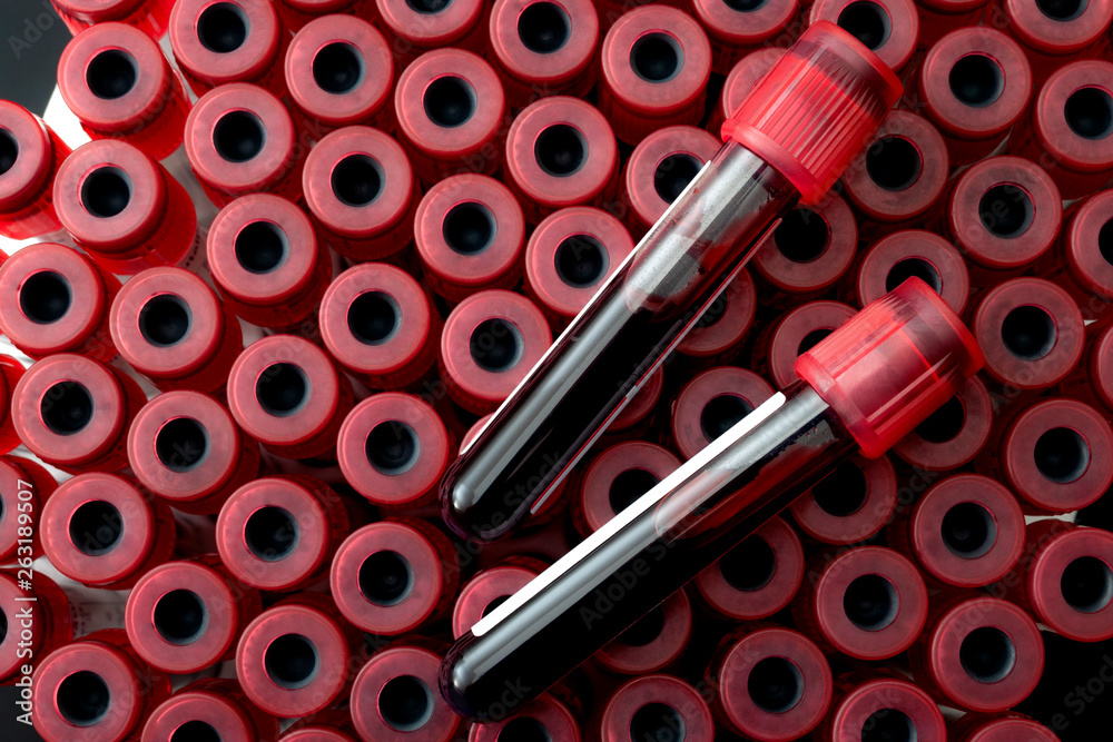 Phlebotomy, biochemical analysis, laboratory exam and blood testing ...