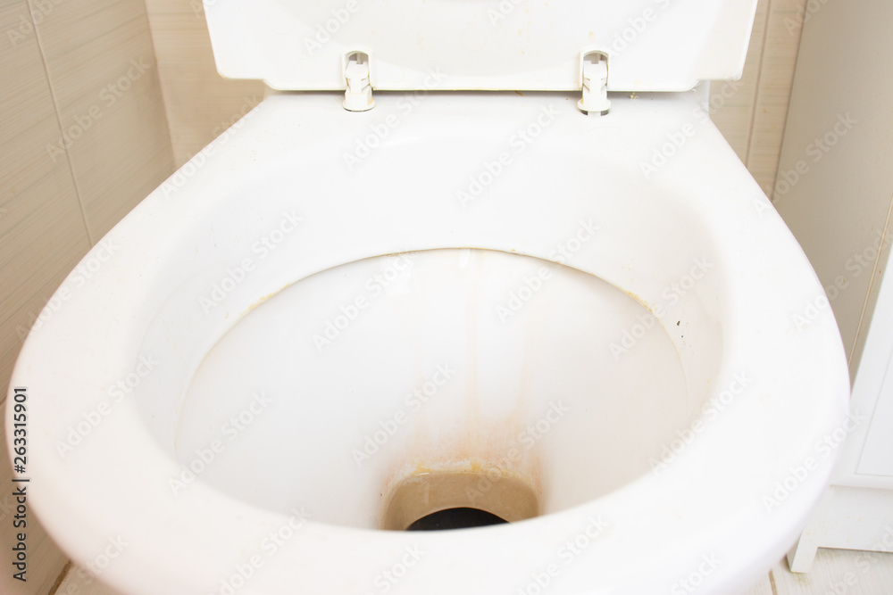 Dirty unhygienic toilet bowl with limescale stain at public restroom ...