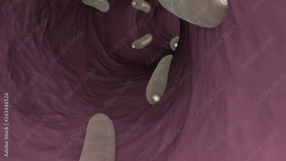 3D animation of parasitic worms in an intestines of human or animal ...