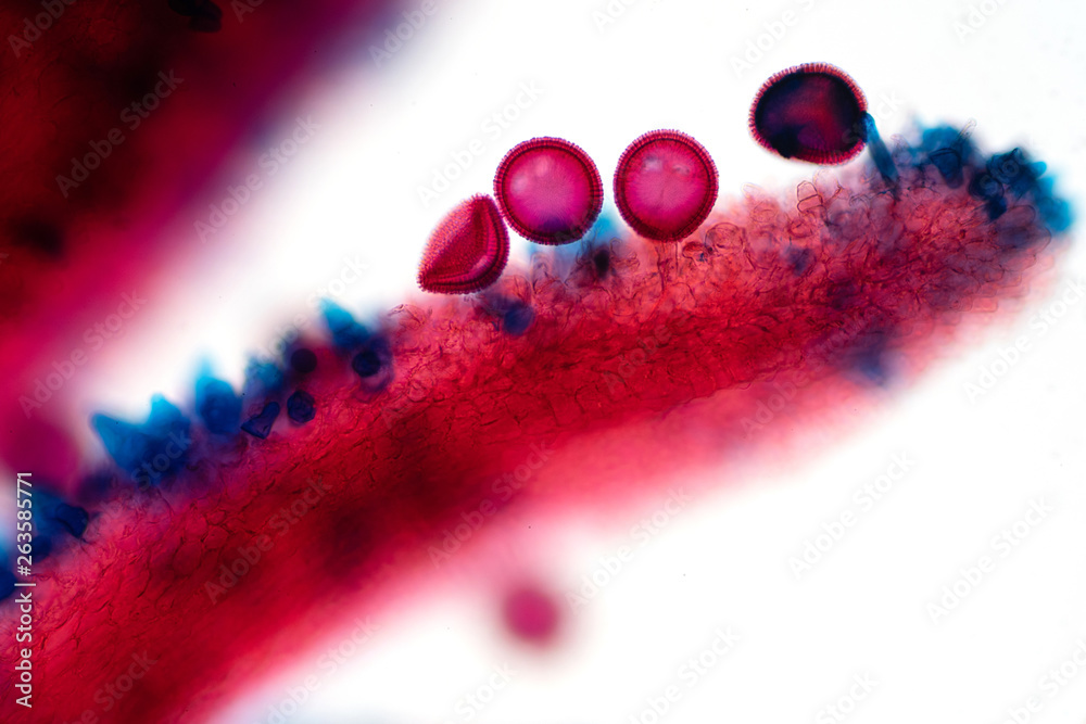 Pollen grain is a microscopic body that contains the male reproductive ...