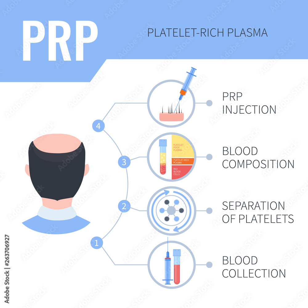 Platelet rich plasma injection procedure. PRP therapy process for men ...
