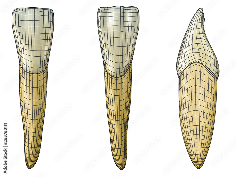 mandibular central incisor tooth in the vestibular, palatal and lateral ...