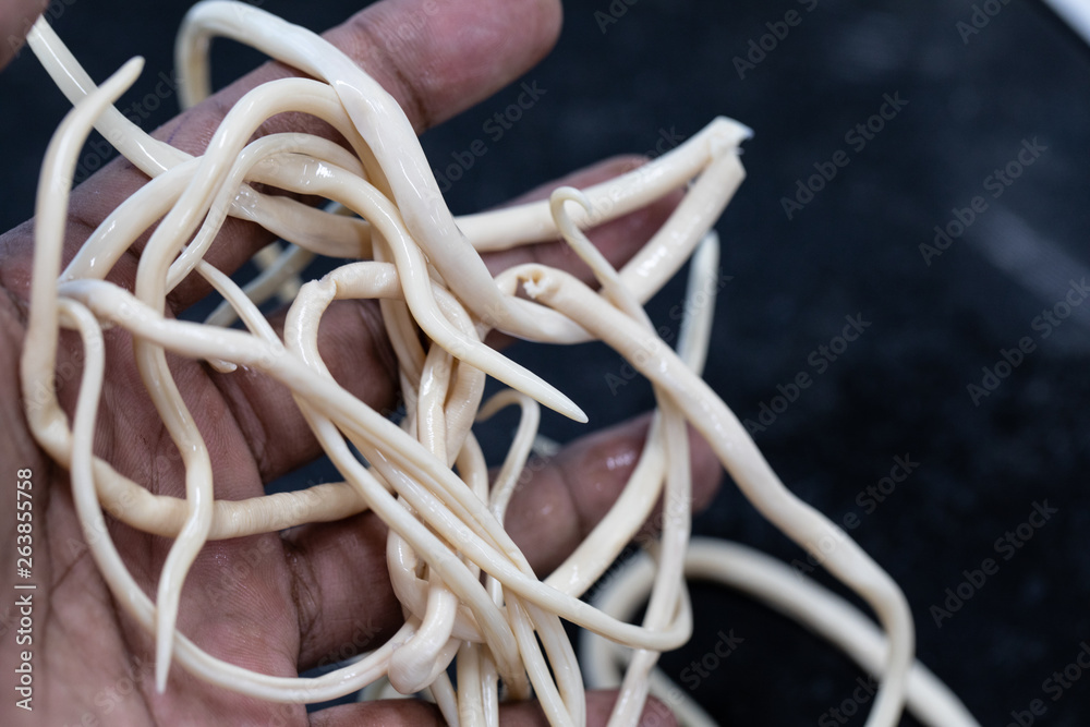 Ascariasis is a disease caused by the parasitic roundworm Ascaris ...