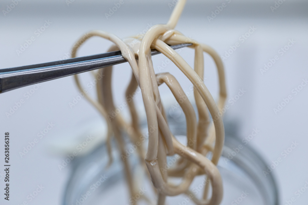 Ascariasis is a disease caused by the parasitic roundworm Ascaris ...