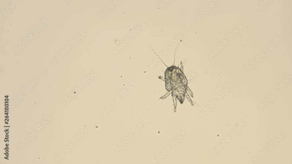 larva a granary or flour mite under a microscope, differs from adult ...