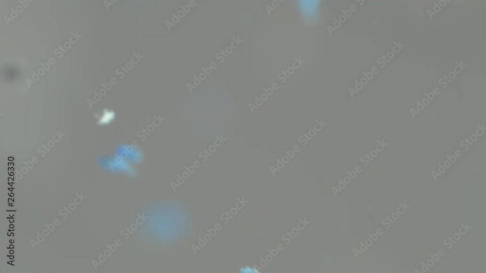 Microparticles of plastic in aquatic environment. Macro shooting of ...