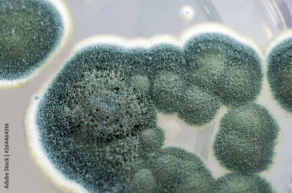 Colonies of Penicillium fungi grown on Sabouraud Dextrose Agar ...