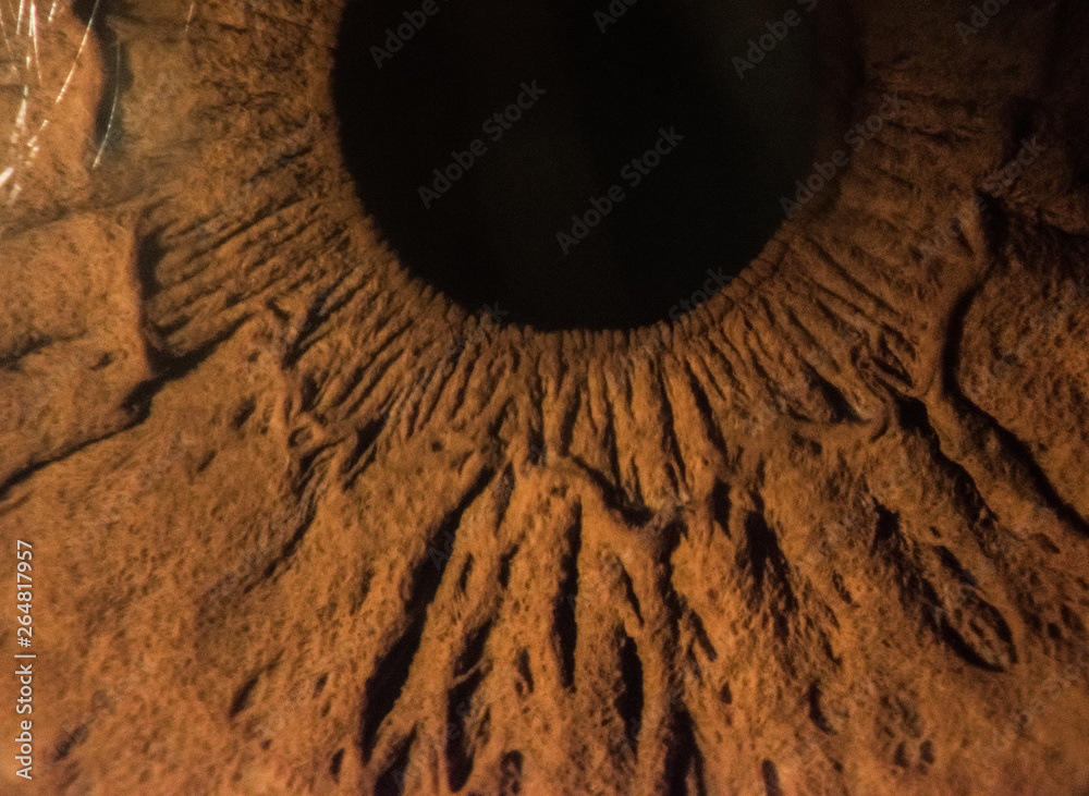 close-up images of human eye, iris and cornea from slit lamp ...