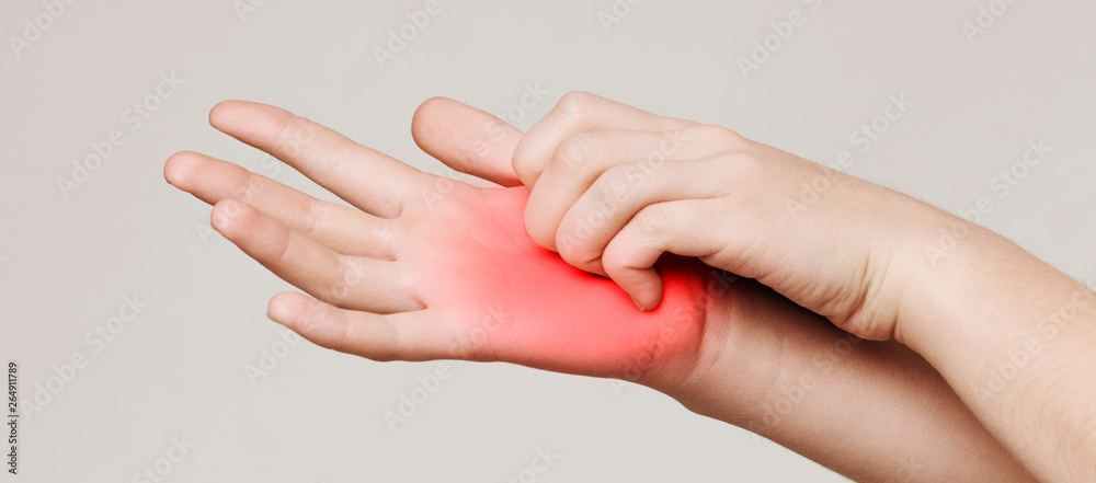 Woman scratching her itchy palm with rash Stock Photo | Adobe Stock