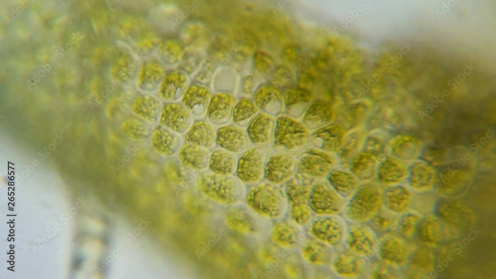 Chloroplast under a microscope. Chloroplasts in plant cells. Cell structure view of leaf surface ...