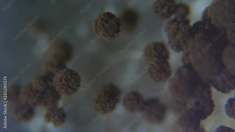 Mold under the microscope. GMO. DNA. Black Mold taken from rotten bread ...