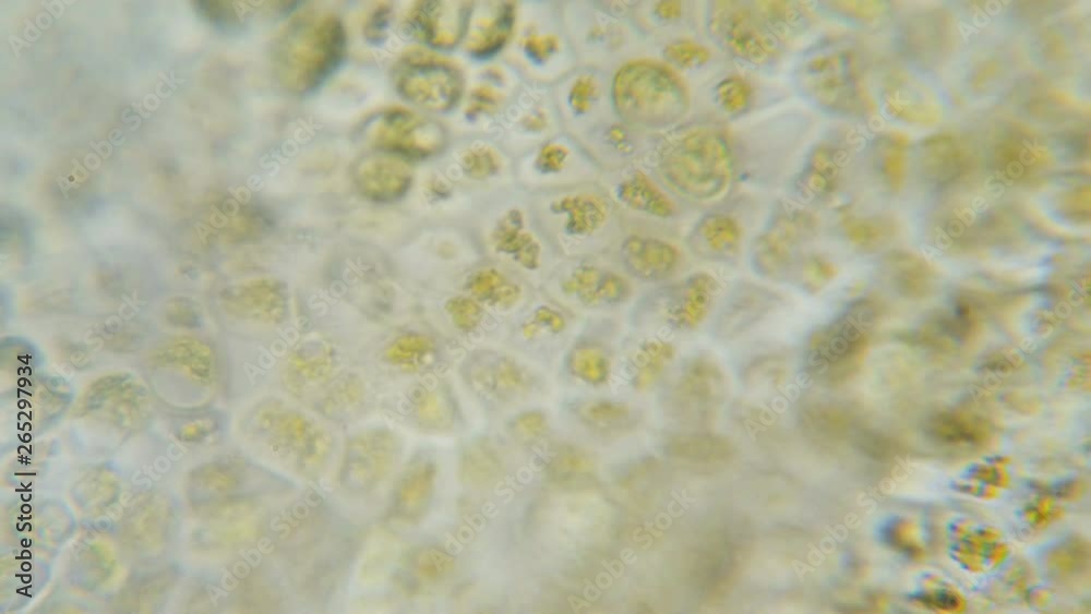 Chloroplast under a microscope. Chloroplasts in plant cells. Cell structure view of leaf surface ...