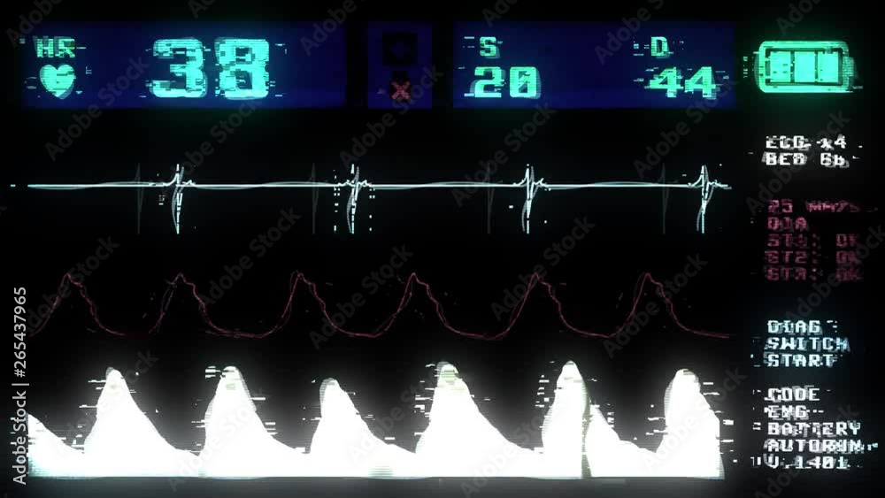 Intentional distortion artifacts (holographic transmission): the screen ...