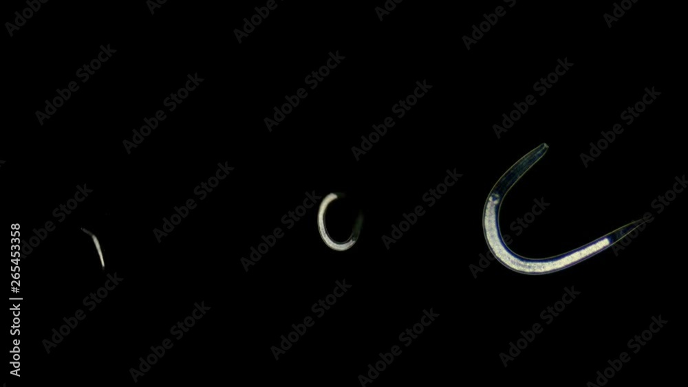 nematode worm under a microscope, a parasite worm at different ...
