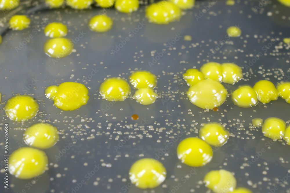 Bacteria grown from skin smear, colonies of Micrococcus luteus and ...