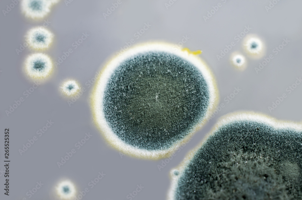 Cheese Mold Under Microscope