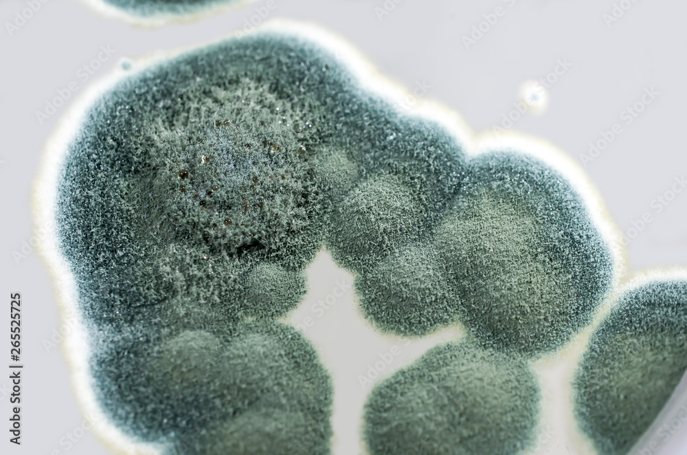 Colonies of Penicillium fungi grown on Sabouraud Dextrose Agar ...