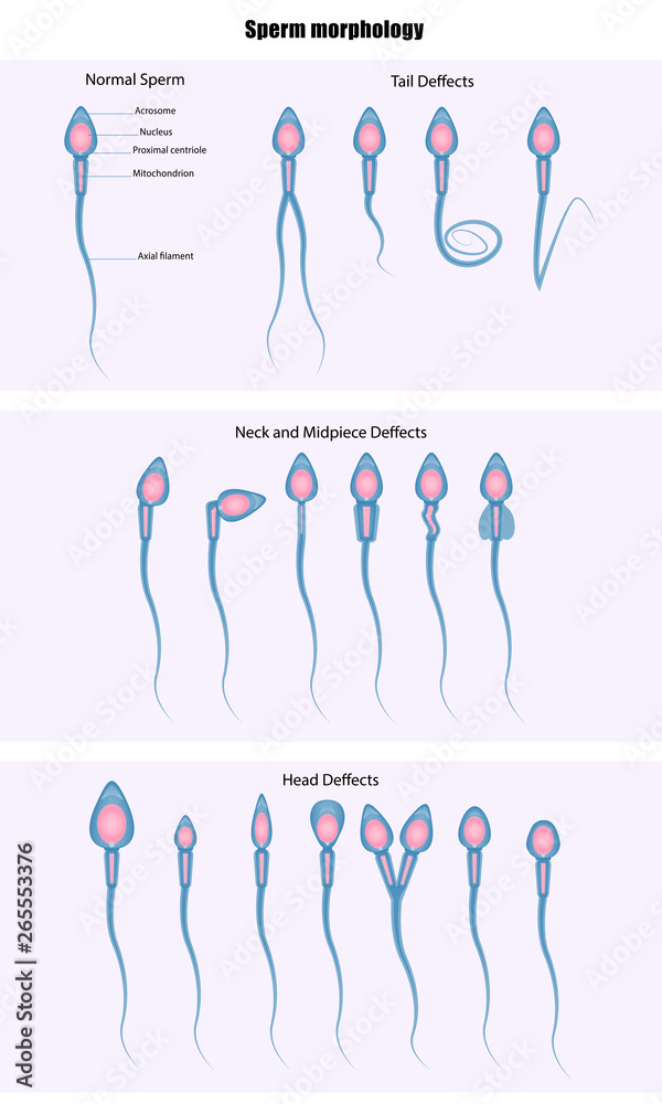 Sperm morphology, Vector diagram for your design, educational, science ...