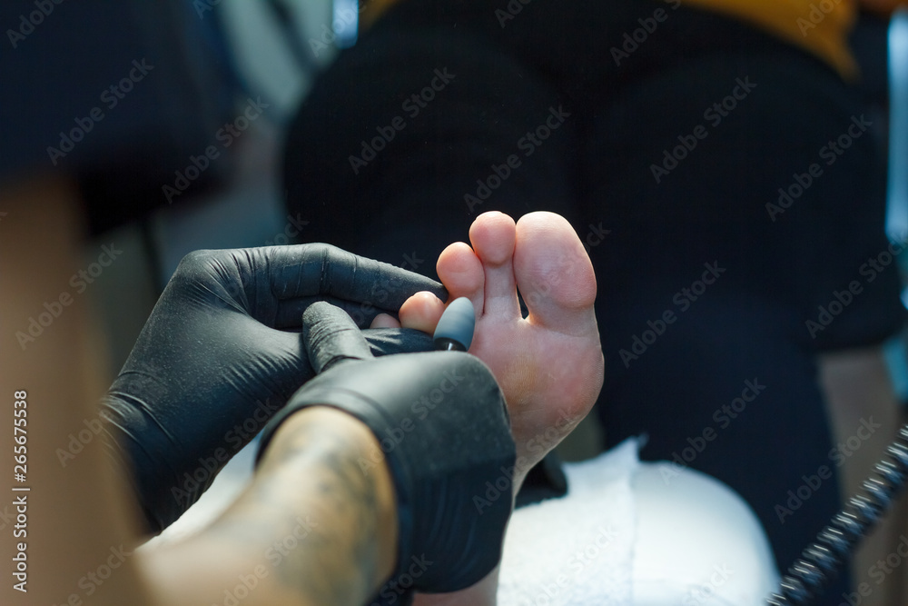 Medical pedicure. Podologist develops feet with a milling machine Stock ...