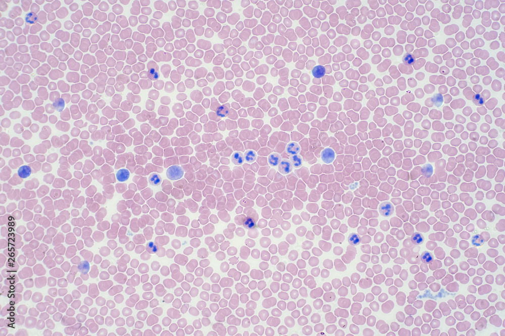 Blood cells under microscope view for histology education. Stock Photo ...