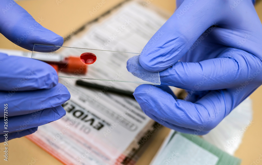 Specialized police taking shows blood in microscope holder to analyze ...
