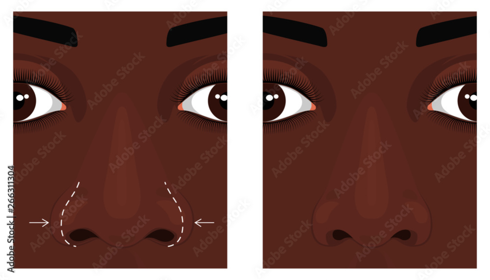 Human Nose Front View