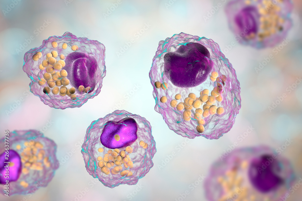 Foam cell, a macrophage cell with lipid droplets Stock Illustration ...