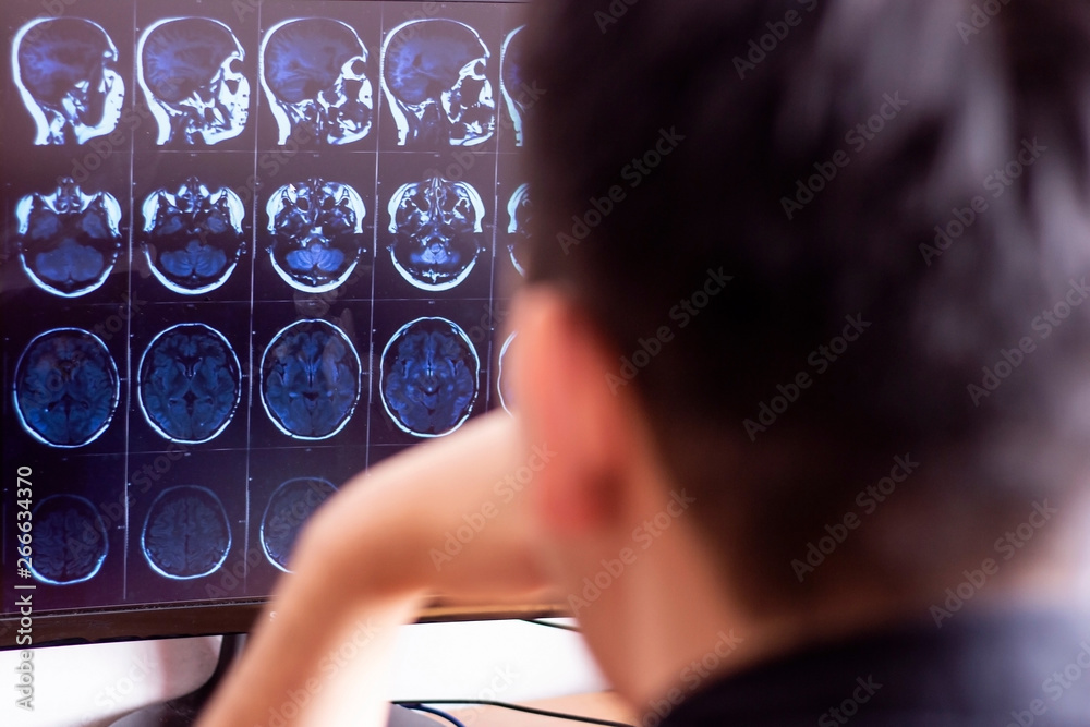 Foto de Doctor radiologist in hospital looking at x-ray mri scan of ...
