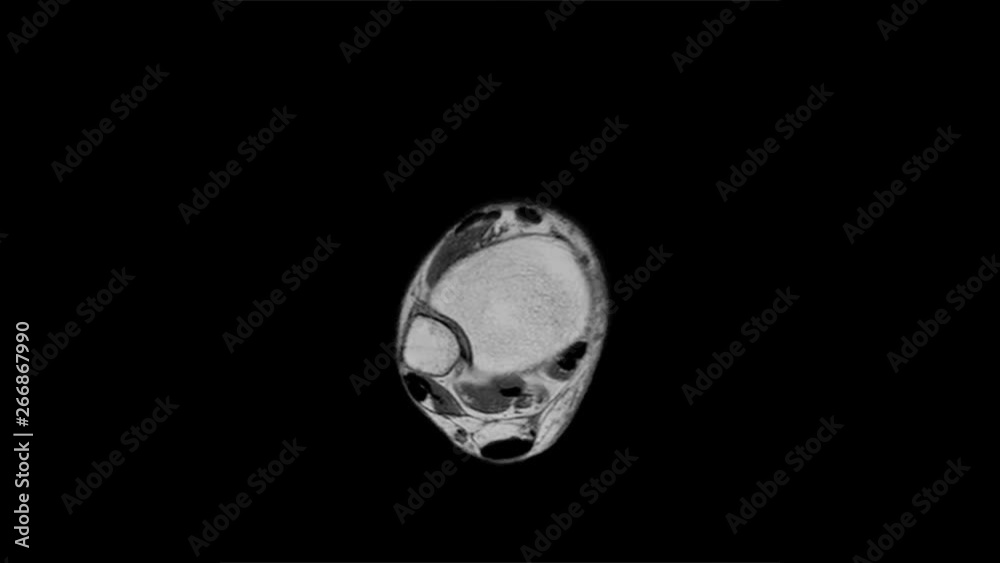 Vidéo Stock Time Lapse video animation of R.M.N. Nuclear magnetic ...