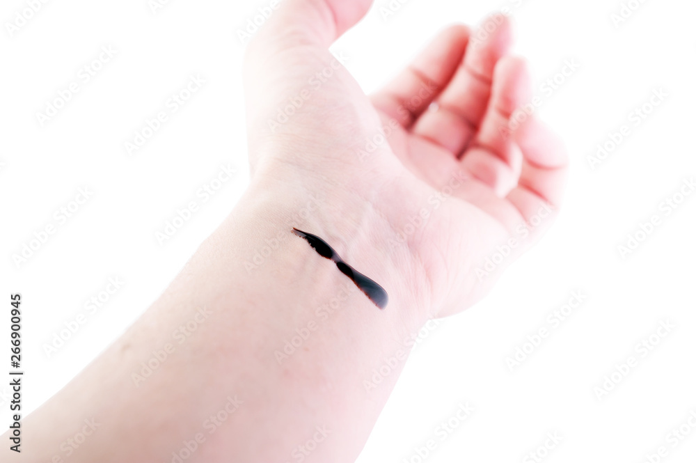 Arm is wound from a knife. A vein cut on the arm is bleeding. Stock ...