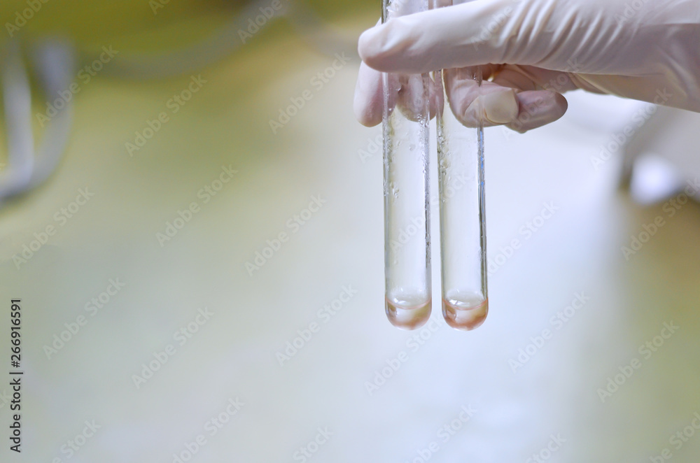 Determination of reducing sugars by Nelson-Somogyi method Stock Photo ...