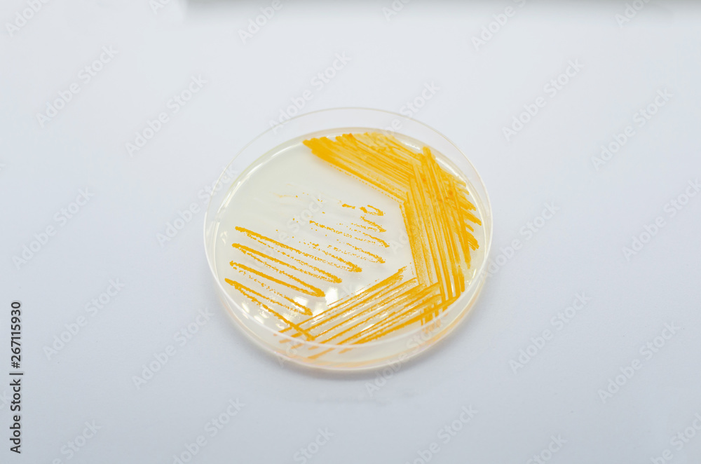 Orange colonies of Actinomyces bacteria on agar plate Stock Photo ...