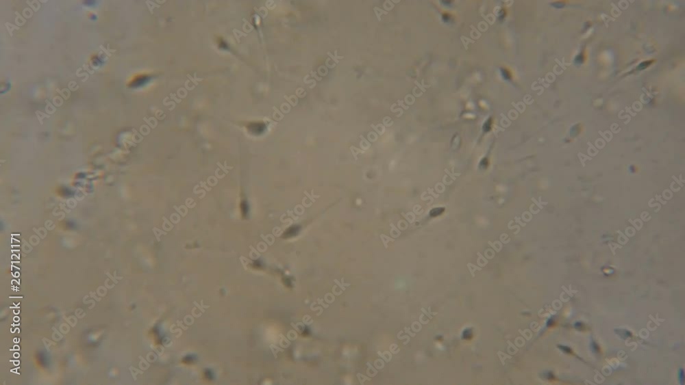 Sperm (spermatozoa) viewed under the microscope. Moving human sperm ...