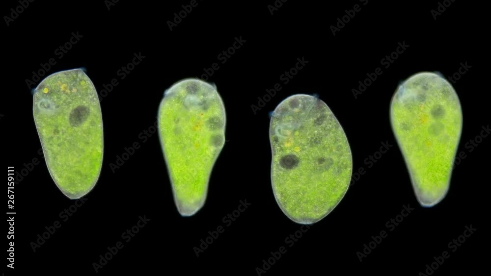 infusoria Stentor under the microscope, the Stentor Koroleus species ...