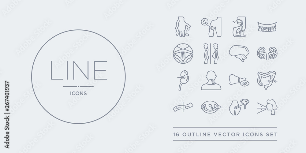 16 line vector icons set such as influenza, interstitial cystitis ...