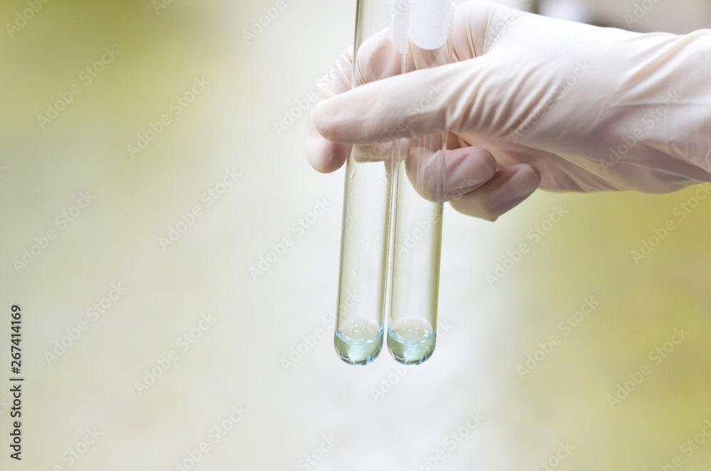 Determination of reducing sugars by Nelson-Somogyi method Stock Photo ...