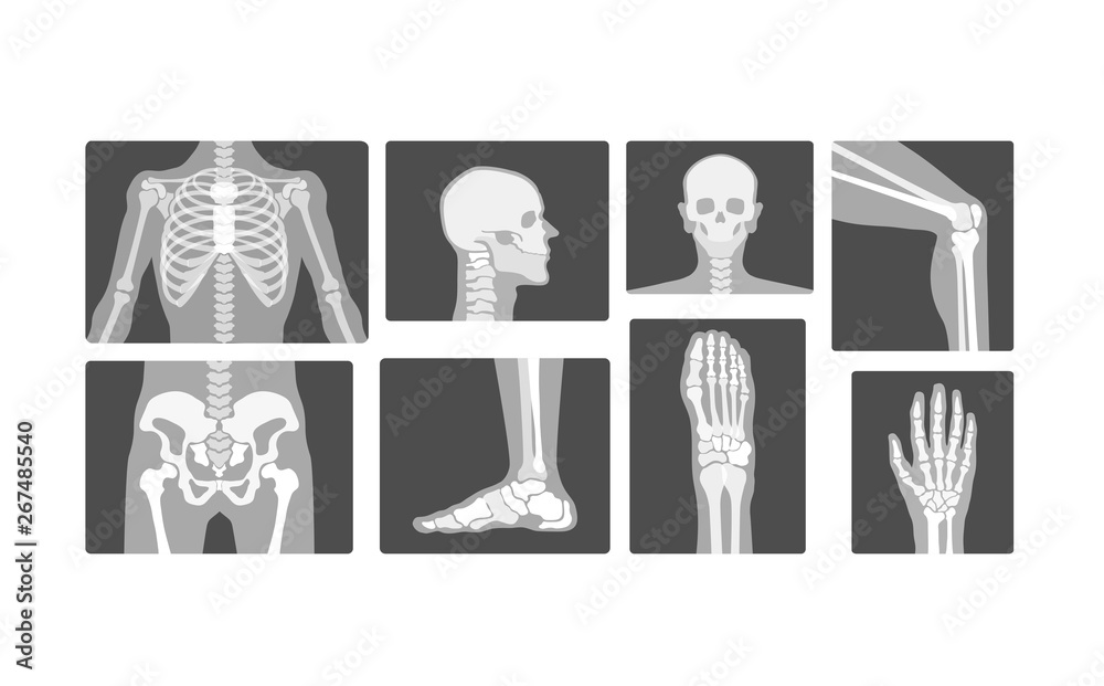 Creative Radiology Skeleton Bones Vector realistic X-ray Logo Design ...