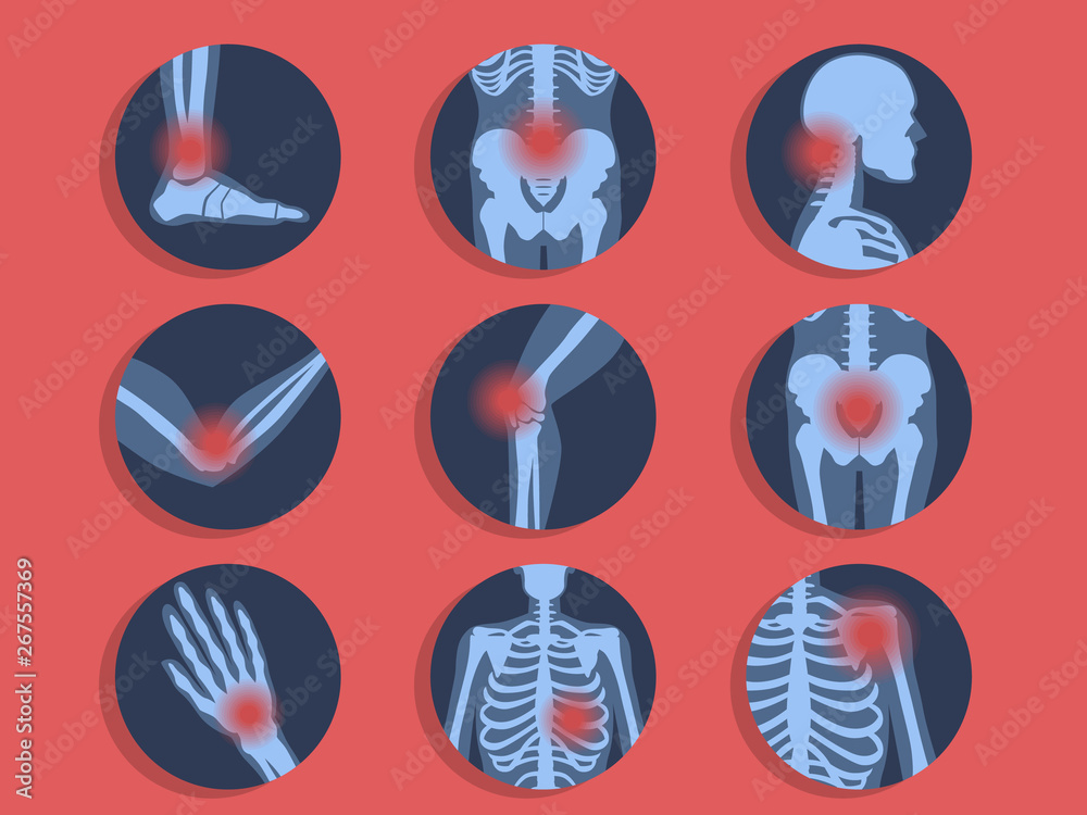 Different types of ache. Headache, abdominal pain Stock Vector | Adobe ...