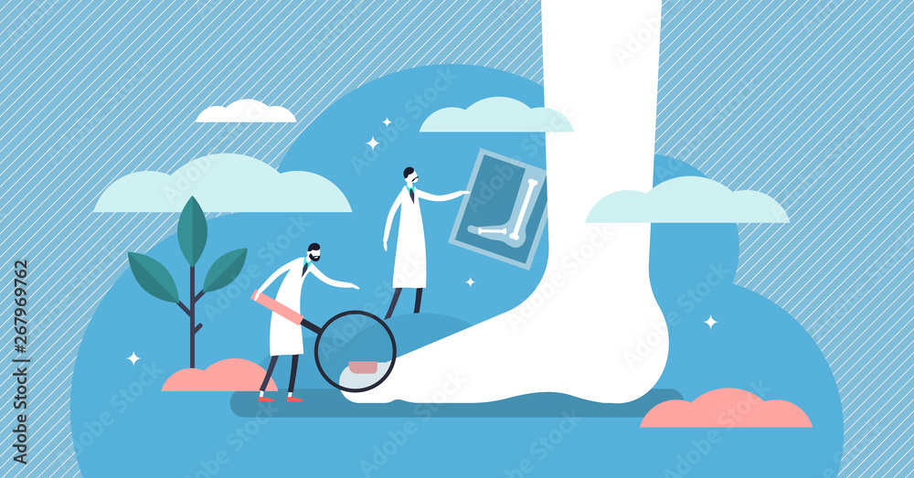 Podiatrist vector illustration. Flat tiny foot ankle disease person ...