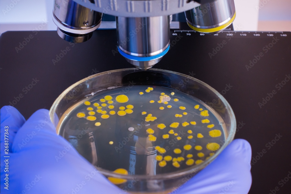 Close-up scientist puts a petri dish under the microscope for analysis ...