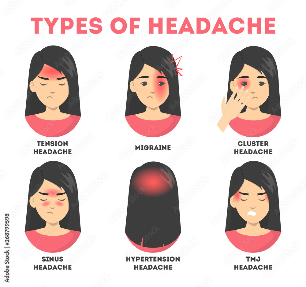 Types of headache set. Stress and sinus ache, migraine Stock Vector ...