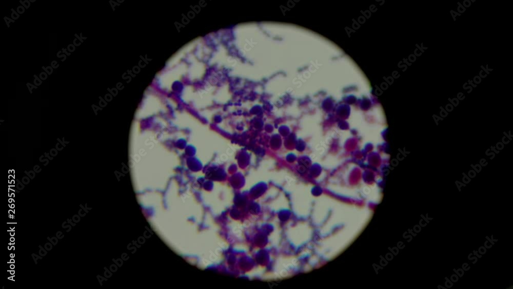 Vidéo Stock A focus changing view of bacteria under the microscope ...