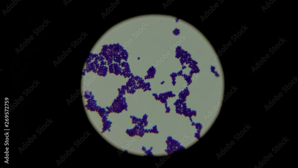 A focus changing shot of staphylococcus bacteria under the microscope ...