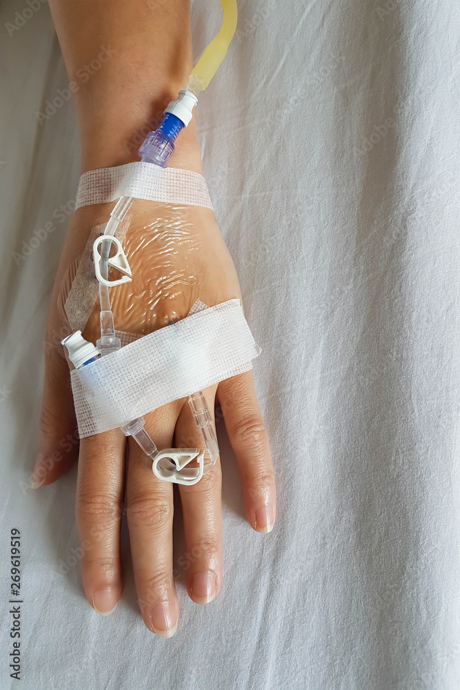 Hand of patient with dropper infusion needle for intravenous infusion ...